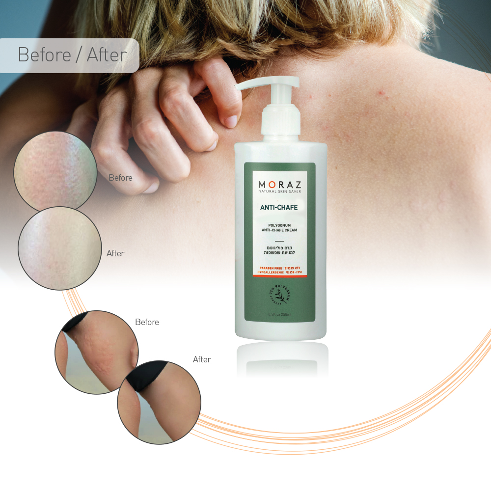 Polygonum Anti-Chafe - Moraz Herbal Extracts